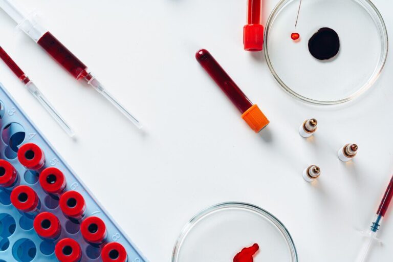 Hemoliza w krwi: przyczyny i jak jej zapobiegać